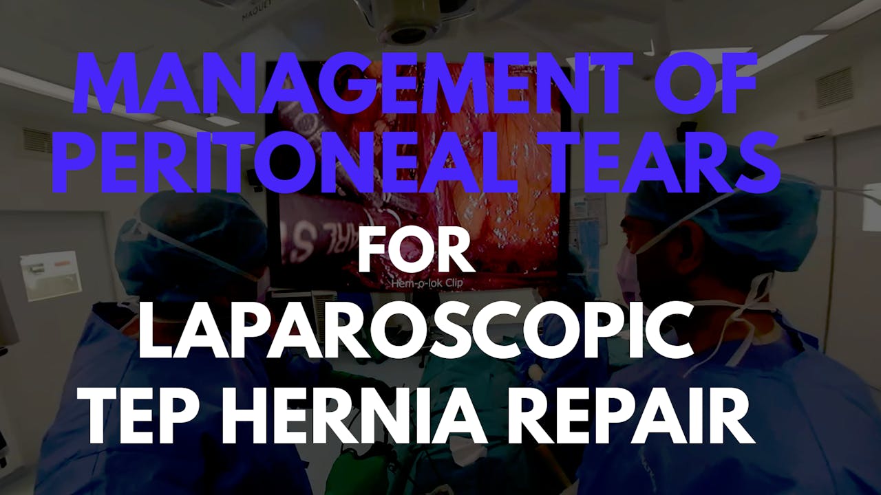 Management of Peritoneal Tears during TEP Inguinal Hernia Repair ...