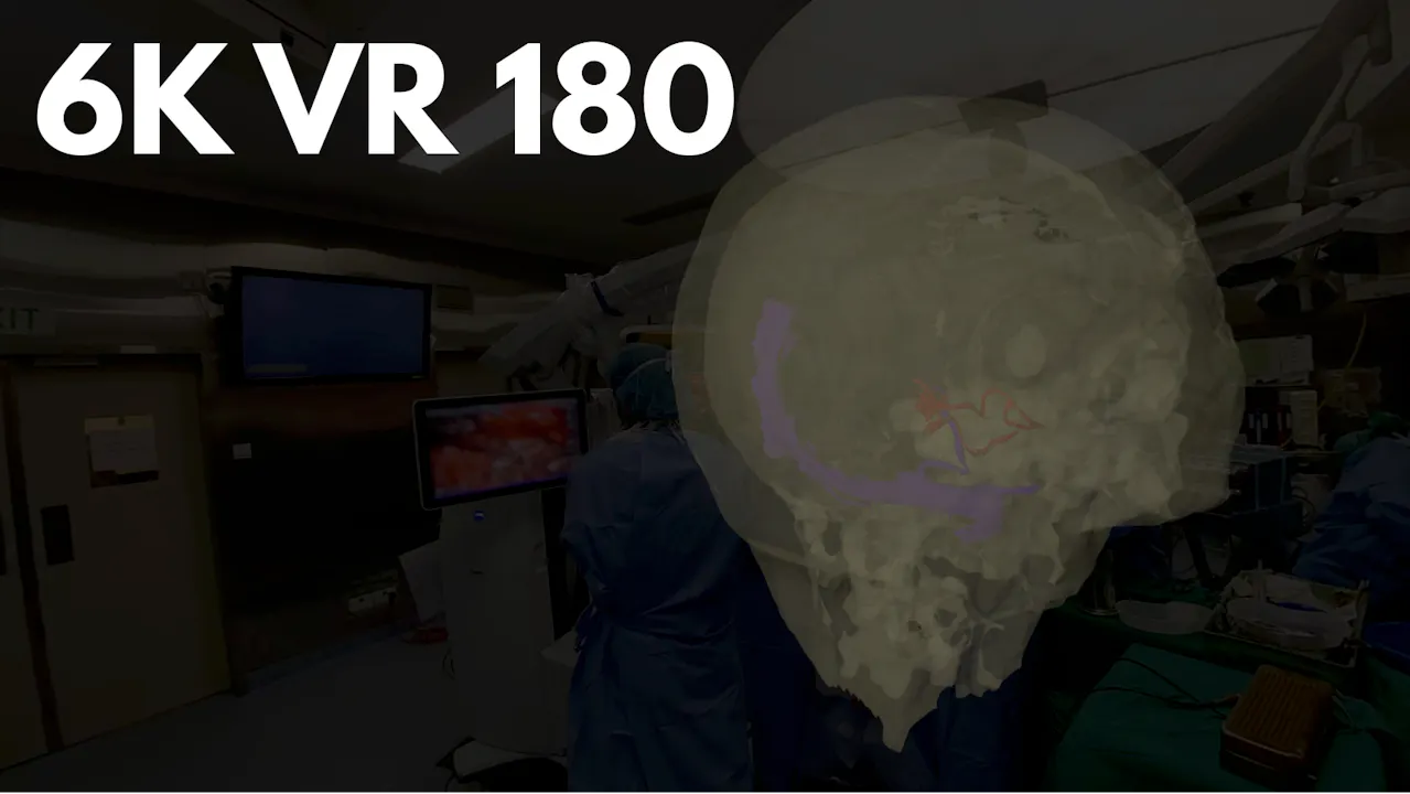 Parietal Convexity Craniotomy - Kyalio Day-to-Day Surgery