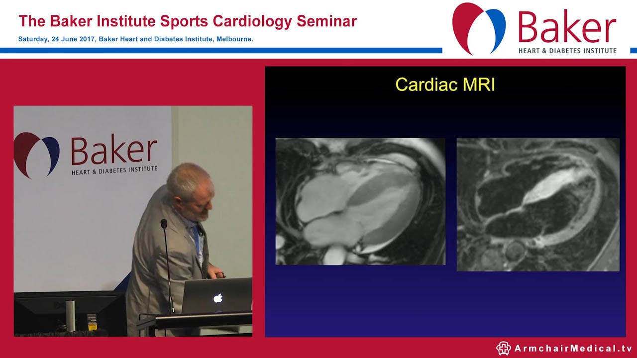 Case: Chest pain in an athlete Assoc Prof David Prior - armchairmedical.tv