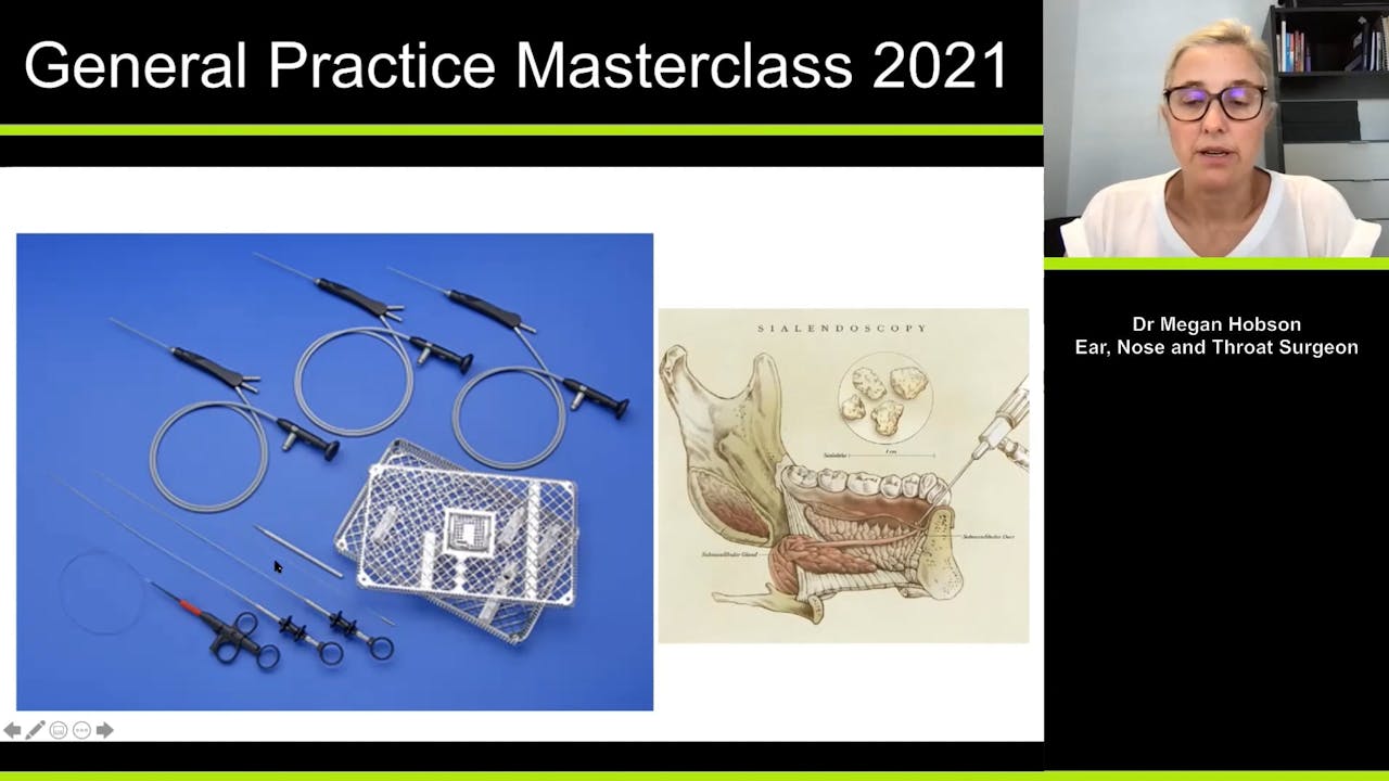 The role of sialendoscopy in the treatment of salivary gland disorders ...