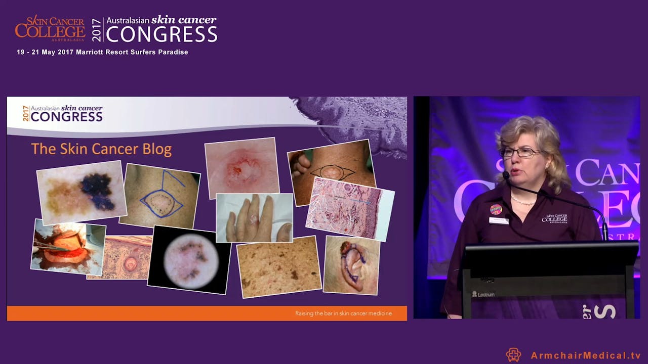 The Skin Cancer College Blog Ms Lynette Hunt - armchairmedical.tv