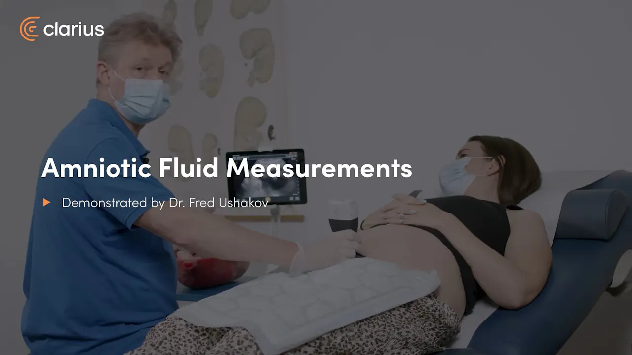 Amniotic Fluid Assessment - Ultrasound Scanning Technique ...
