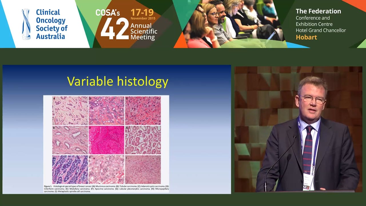 Bruce Mann Rare subtypes of breast cancer - armchairmedical.tv