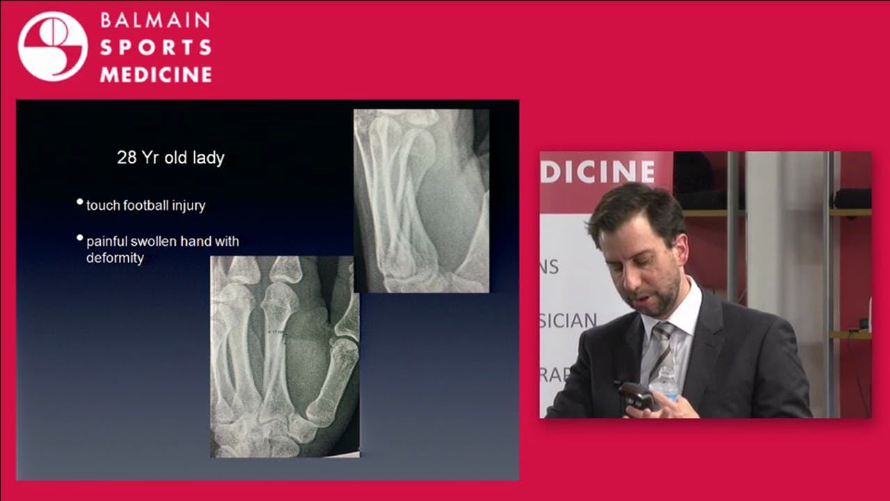 Hand & Wrist cases of relevance to General Practitioners Denard Schick ...