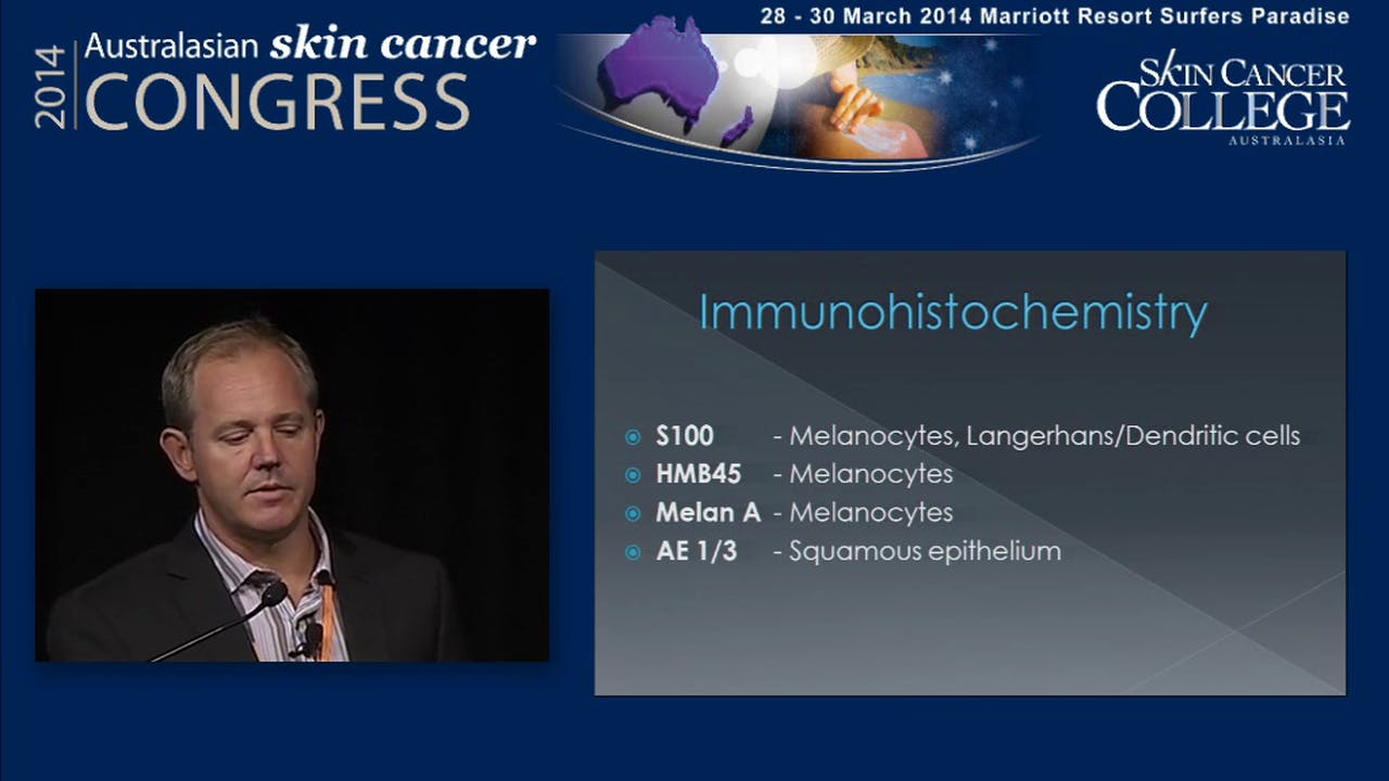 Understanding the Pathology of Lentigo Maligna Dr Angus Collins ...