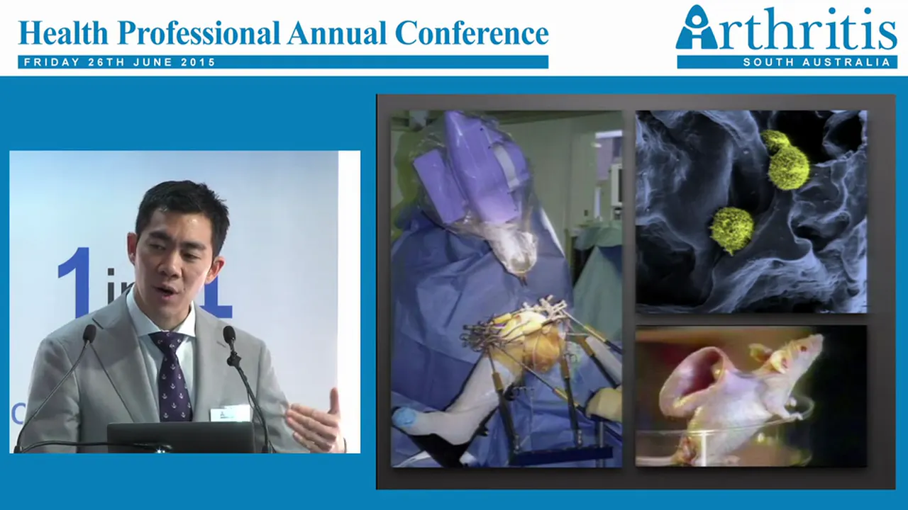 Joint Surgery in the 21st Century Dr Chien-Wen Liew M.B.,B.S. FRACS ...
