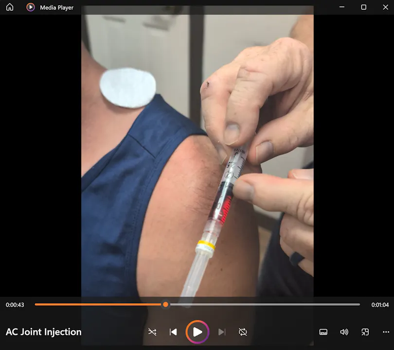 Non-Separated AC Joint Injection with Dennis Harper, ND, DC - OCBM ...