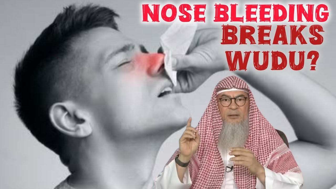Does nose bleeding invalidate my wudu - Haram & Halal - One Islam TV