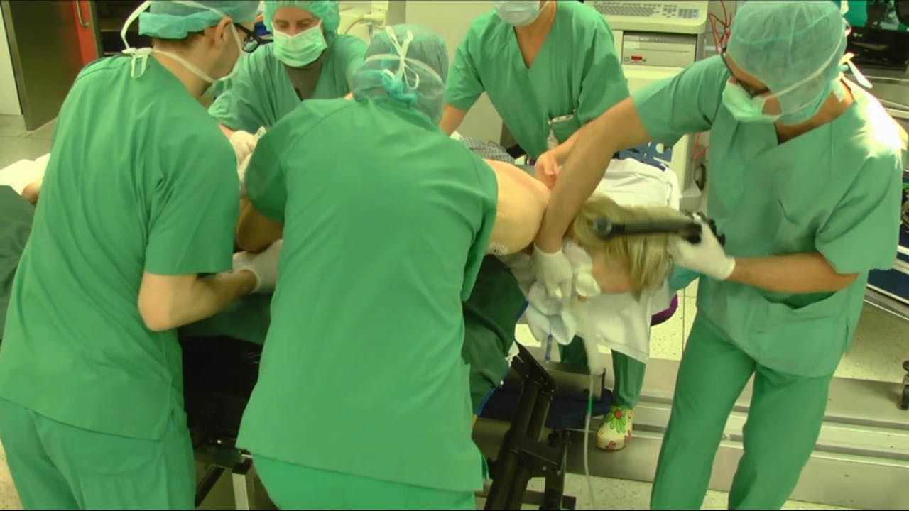 Posterior stabilization of the cervical spine with lateral mass screws ...