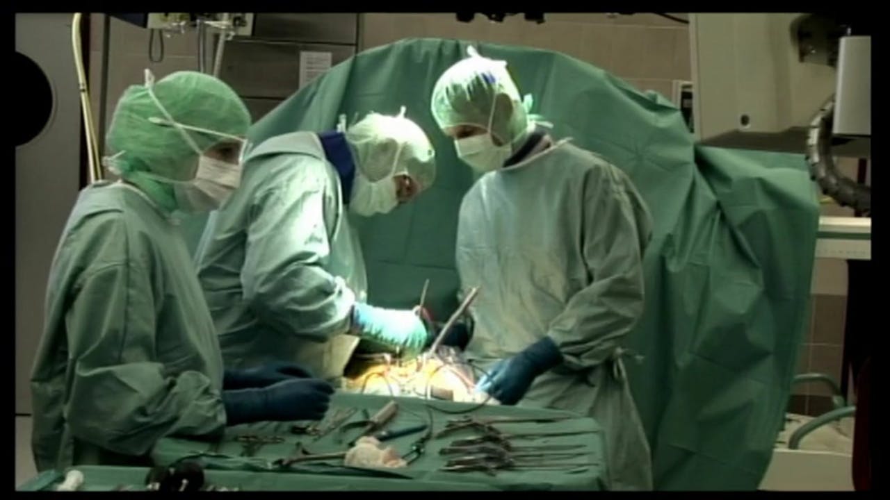 Low grade lytic spondylolisthesis L4-L5 treated with PLIF - Deformities ...