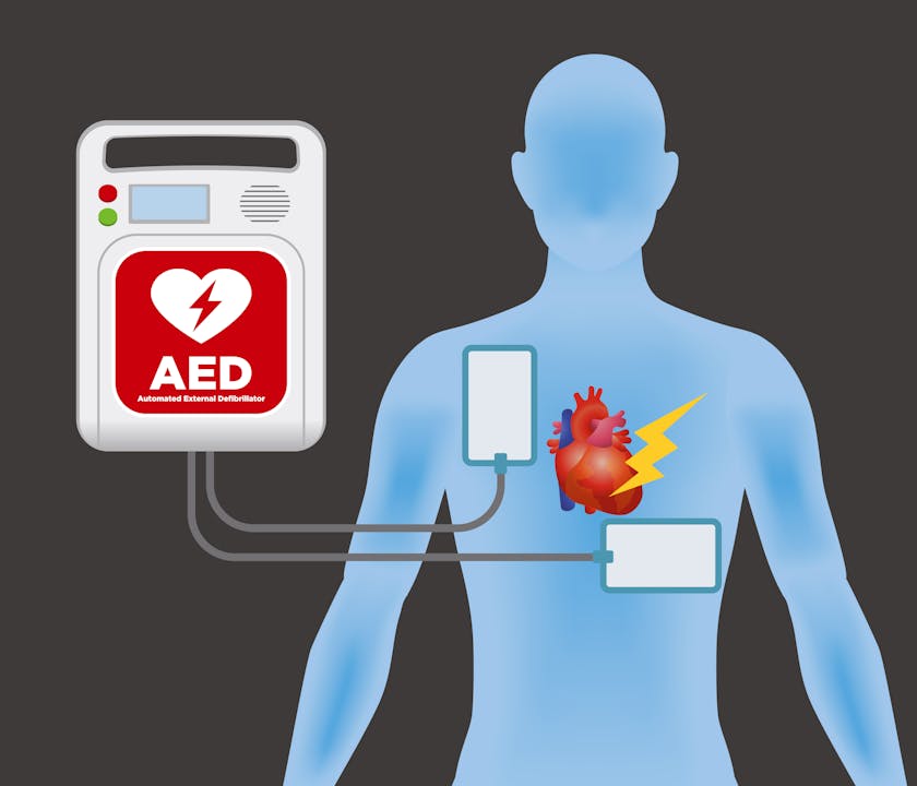 NOW Core Training - The Basics of an AED - NOW Core Training (Exclusive ...