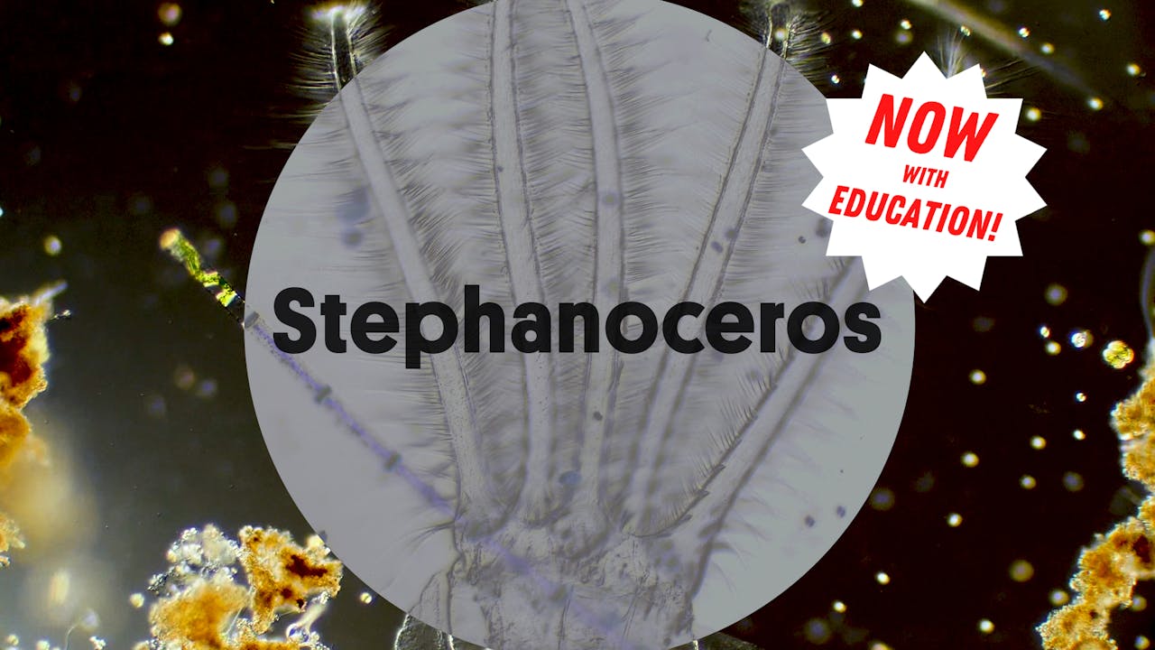 Stephanoceros | narrated - Living Beings - Wonder Science