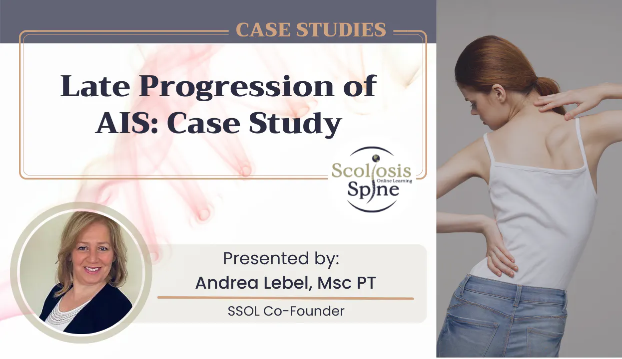 Late Progression of AIS: Case Study - SSOL-GLOBAL