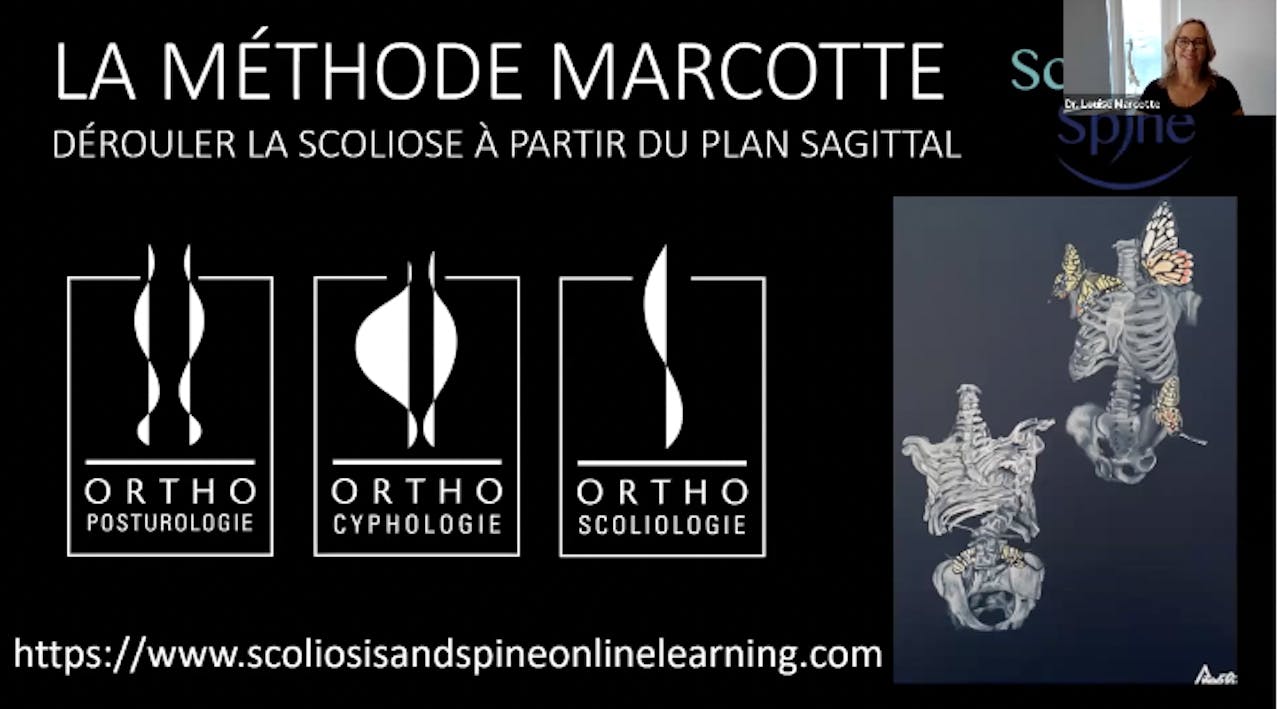 Méthode Marcotte: la scoliose et le plan sagittal - SSOL-GLOBAL