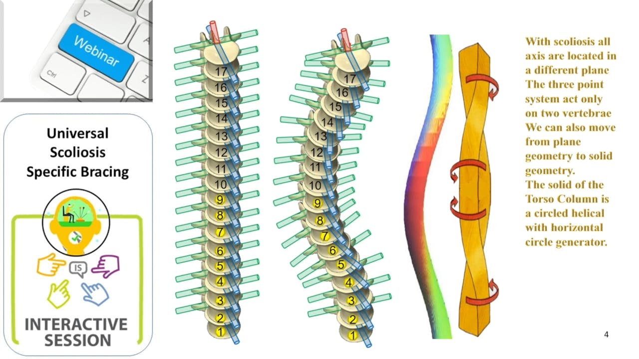 SSOL-Lyon Method Certification: Tutorial 8 (Universal Scoliosis ...