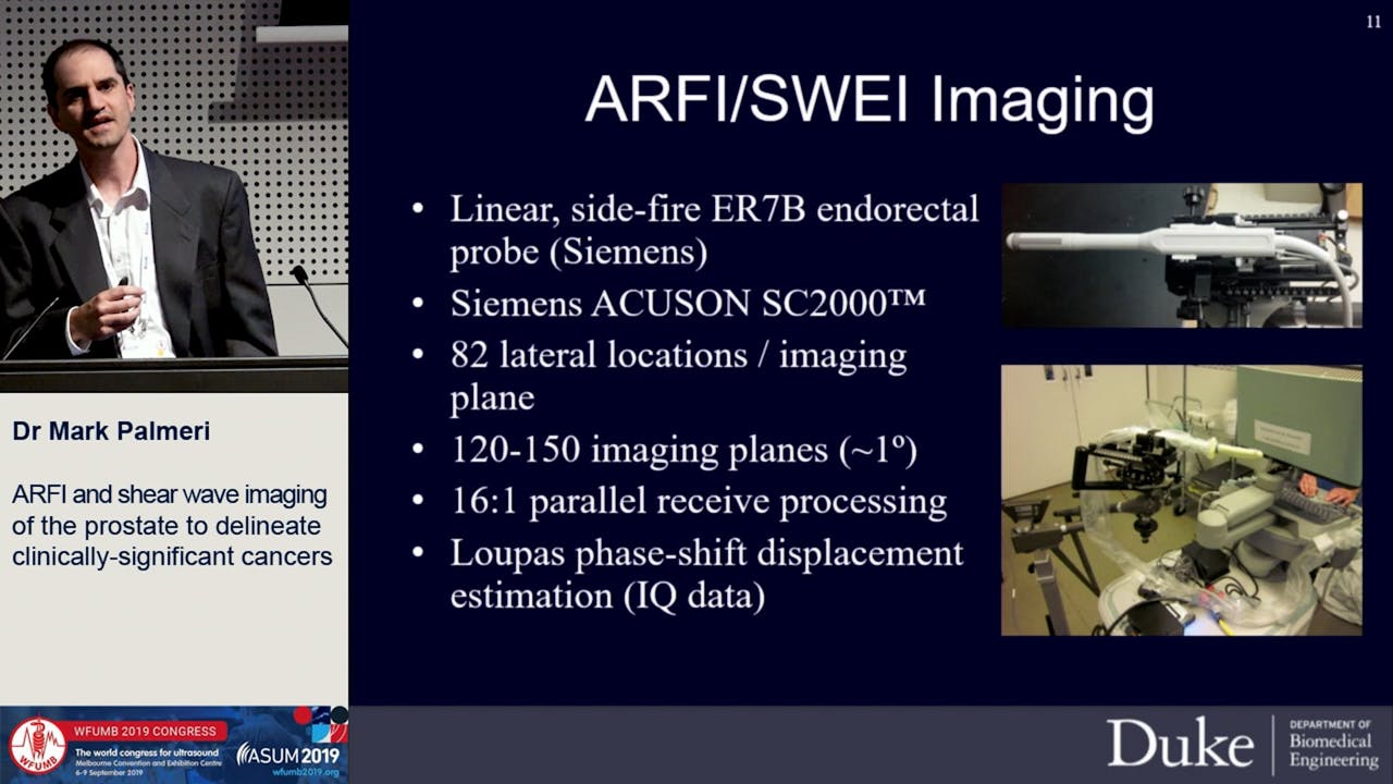 ARFI and shear wave imaging of the prostate - ASUMDrive