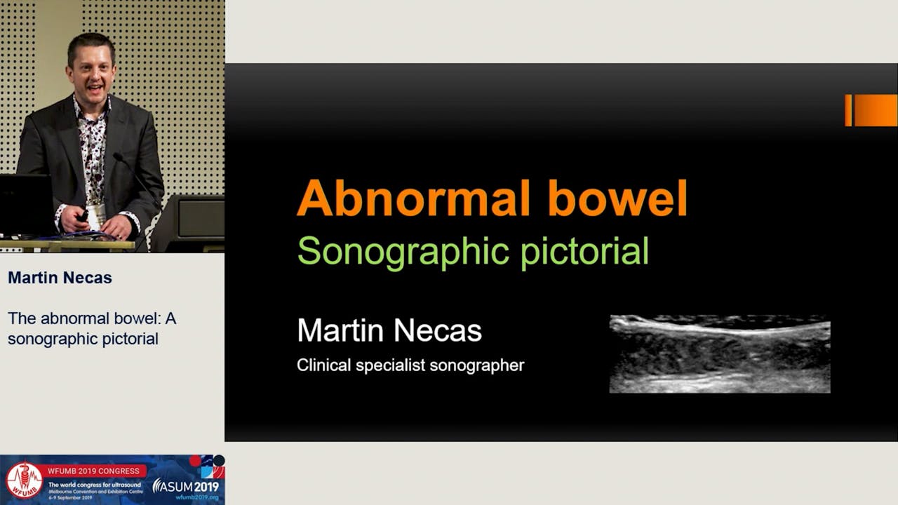 The abnormal bowel: A sonographic pictorial - ASUMDrive