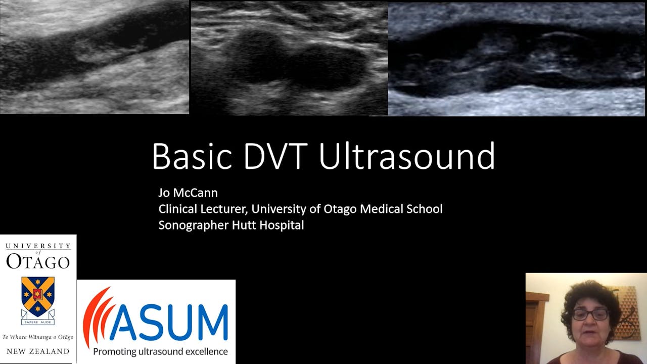 Basic DVT Ultrasound - ASUMDrive
