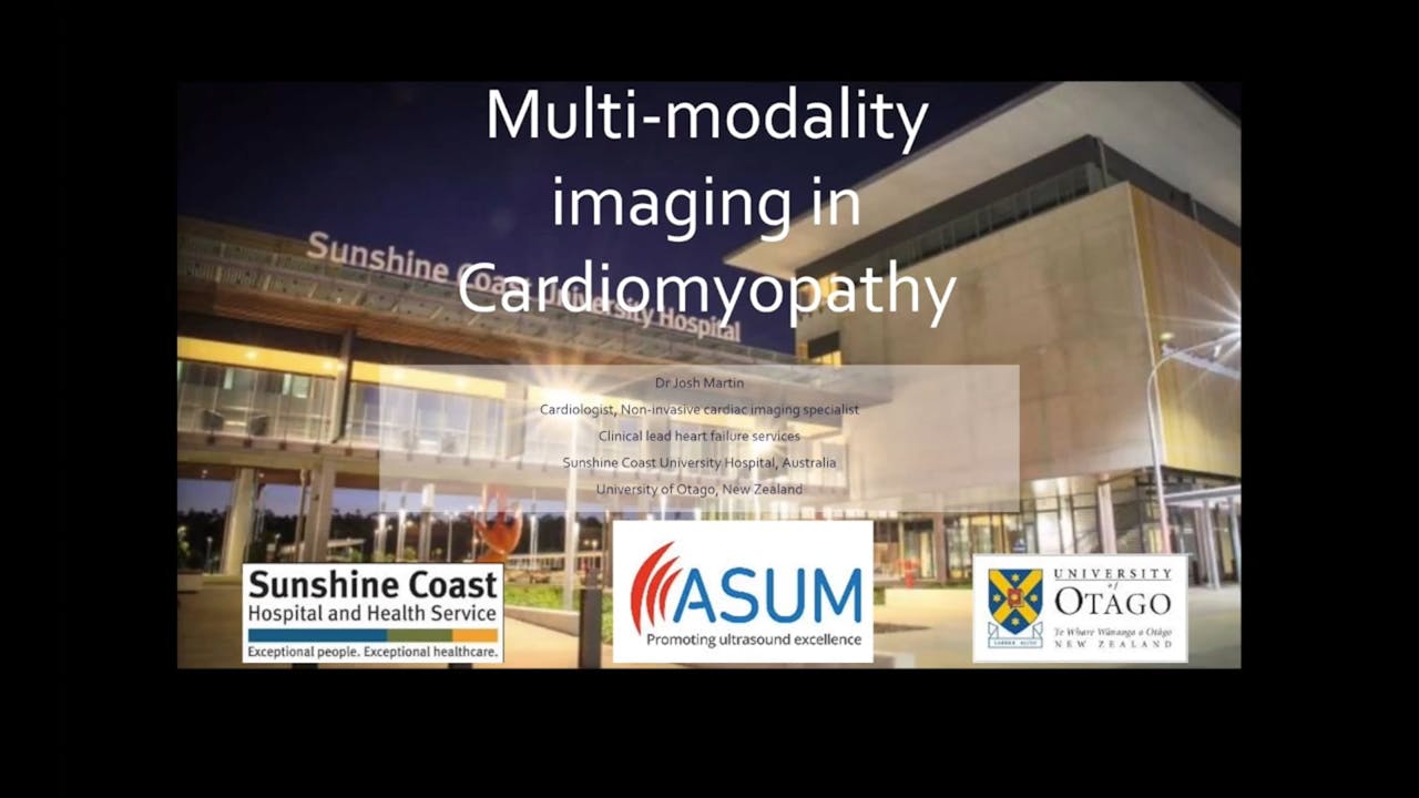 Multi-modality imaging in cardiomyopathy - ASUMDrive