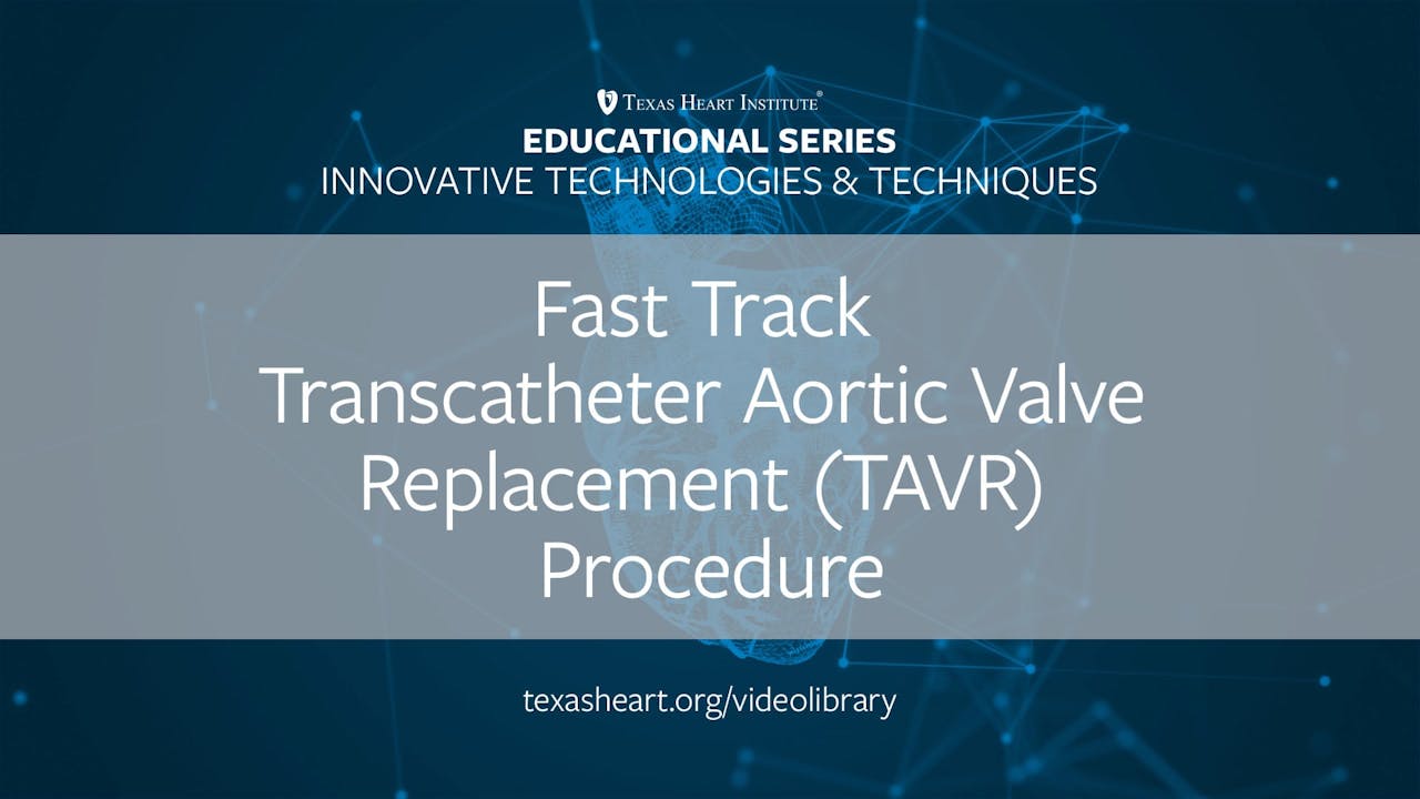Fast Track Transcatheter Aortic Valve Replacement (TAVR) Procedure (0. ...