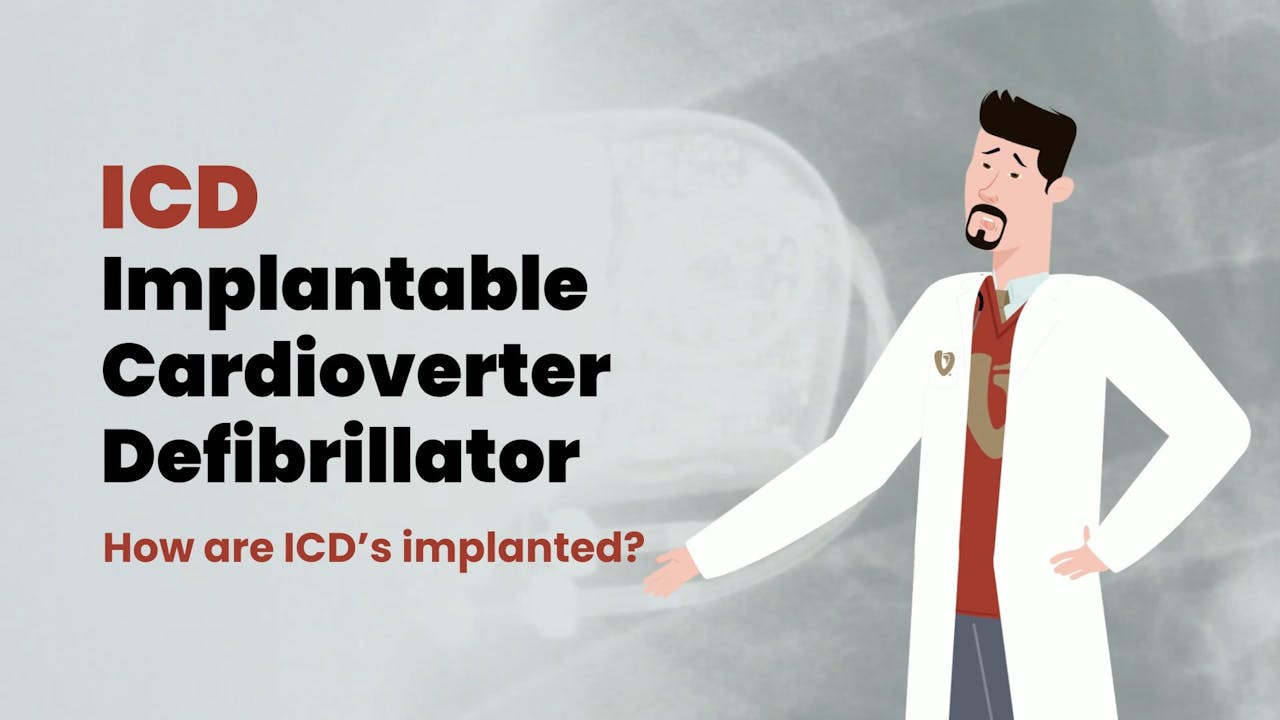 How Does an ICD Work? Your Heart Rhythm Safety Net Explained - Texas ...
