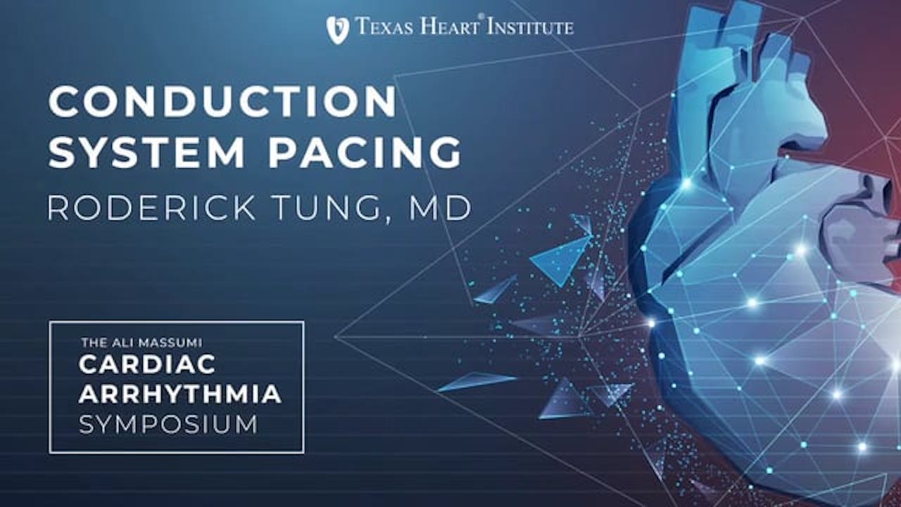 Conduction System Pacing - Texas Heart TV by The Texas Heart Institute ...
